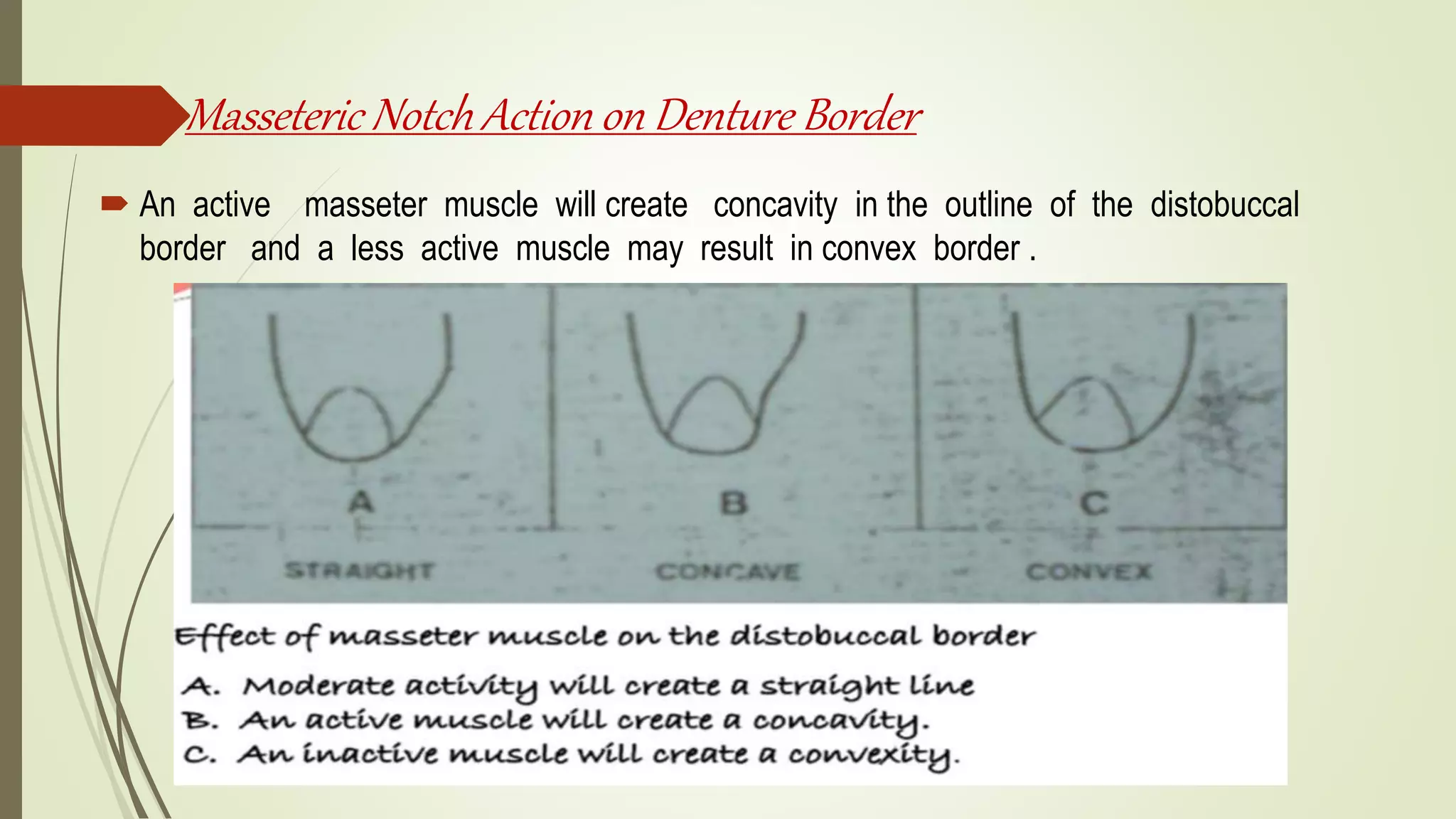 Muscles of mastication prosthodontic consideration | PPTX