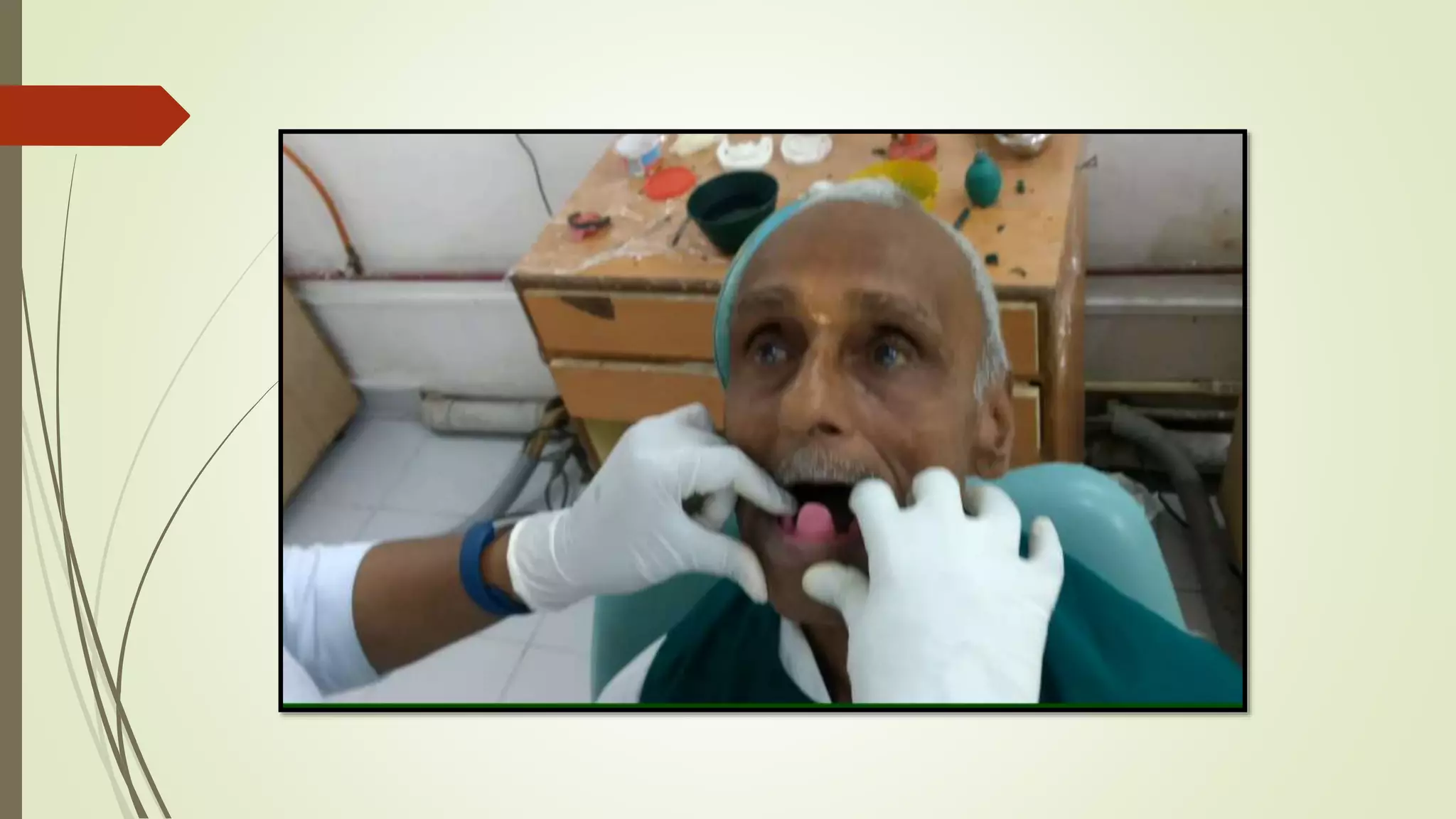 Muscles of mastication prosthodontic consideration | PPTX