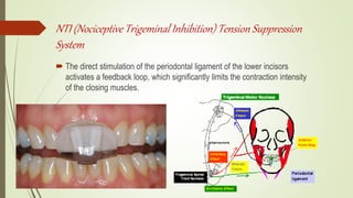 Muscles of mastication prosthodontic consideration | PPTX