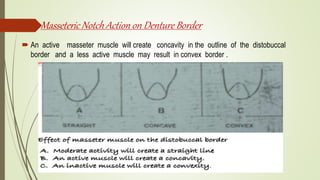 Muscles of mastication prosthodontic consideration | PPTX