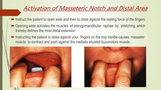 Muscles of mastication prosthodontic consideration | PPTX