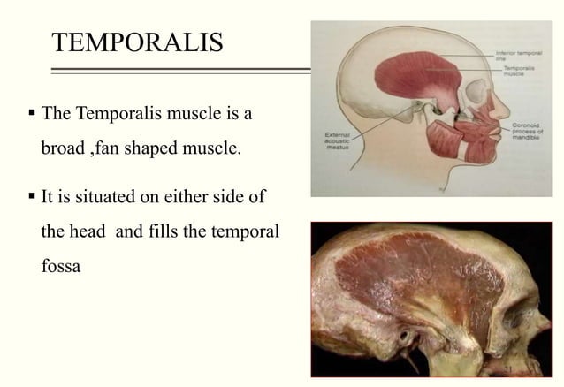 Muscles of mastication and facial expression. | PPTX | Dental Health ...