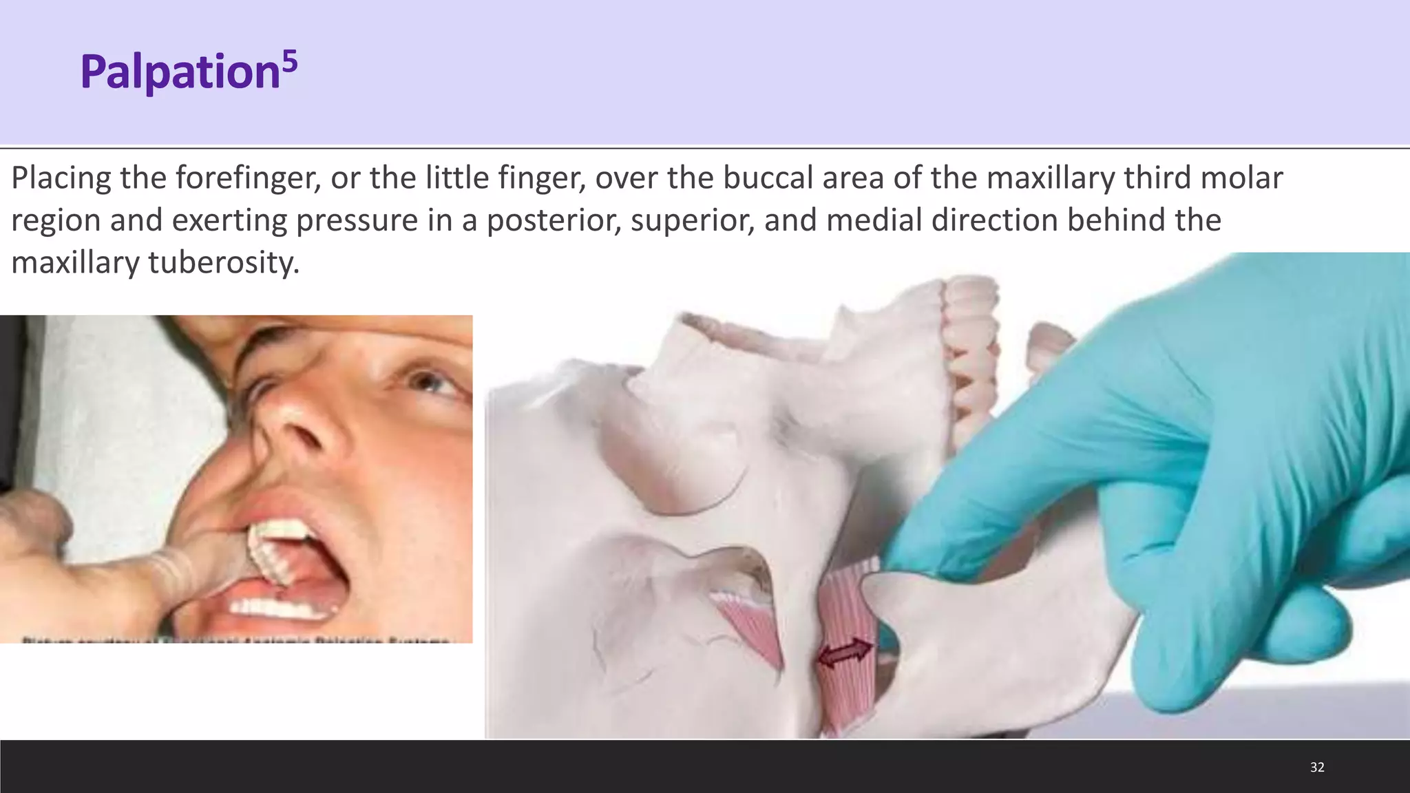 Muscles of mastication and its importance in complete | PPT