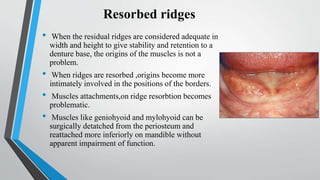 Muscles of mastication FINAL (1).pptx and it's anatomy | PPTX