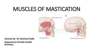 MUSCLES OF MASTICATION and chewing cycle | PPTX