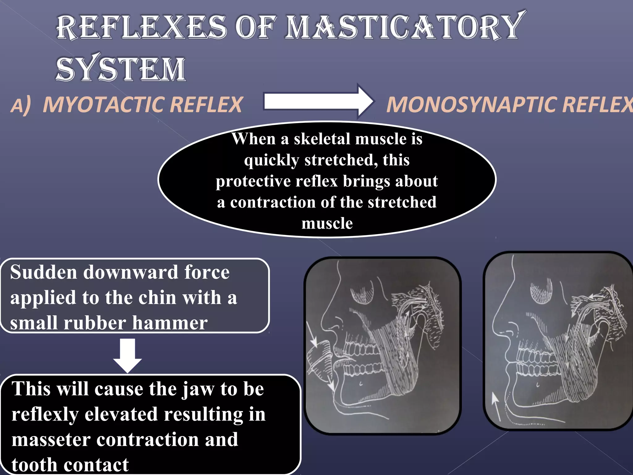 Muscles of mastication ppt | PPT