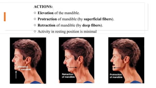 Muscles of Mastication ppt revised.pptx