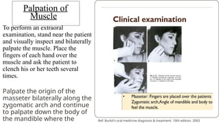 Muscles of Mastication ppt revised.pptx