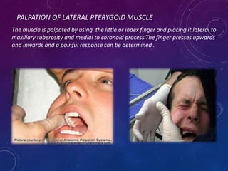 Muscles of mastication presentation | PPTX