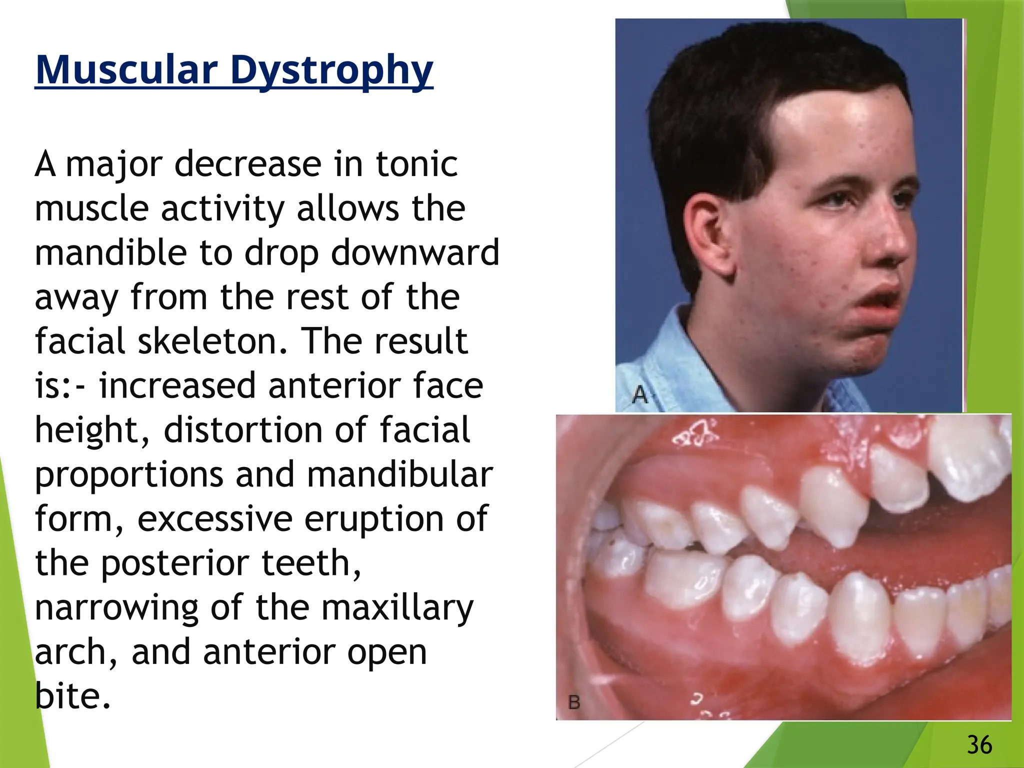 Muscles of Mastication Sourav guin .pptx