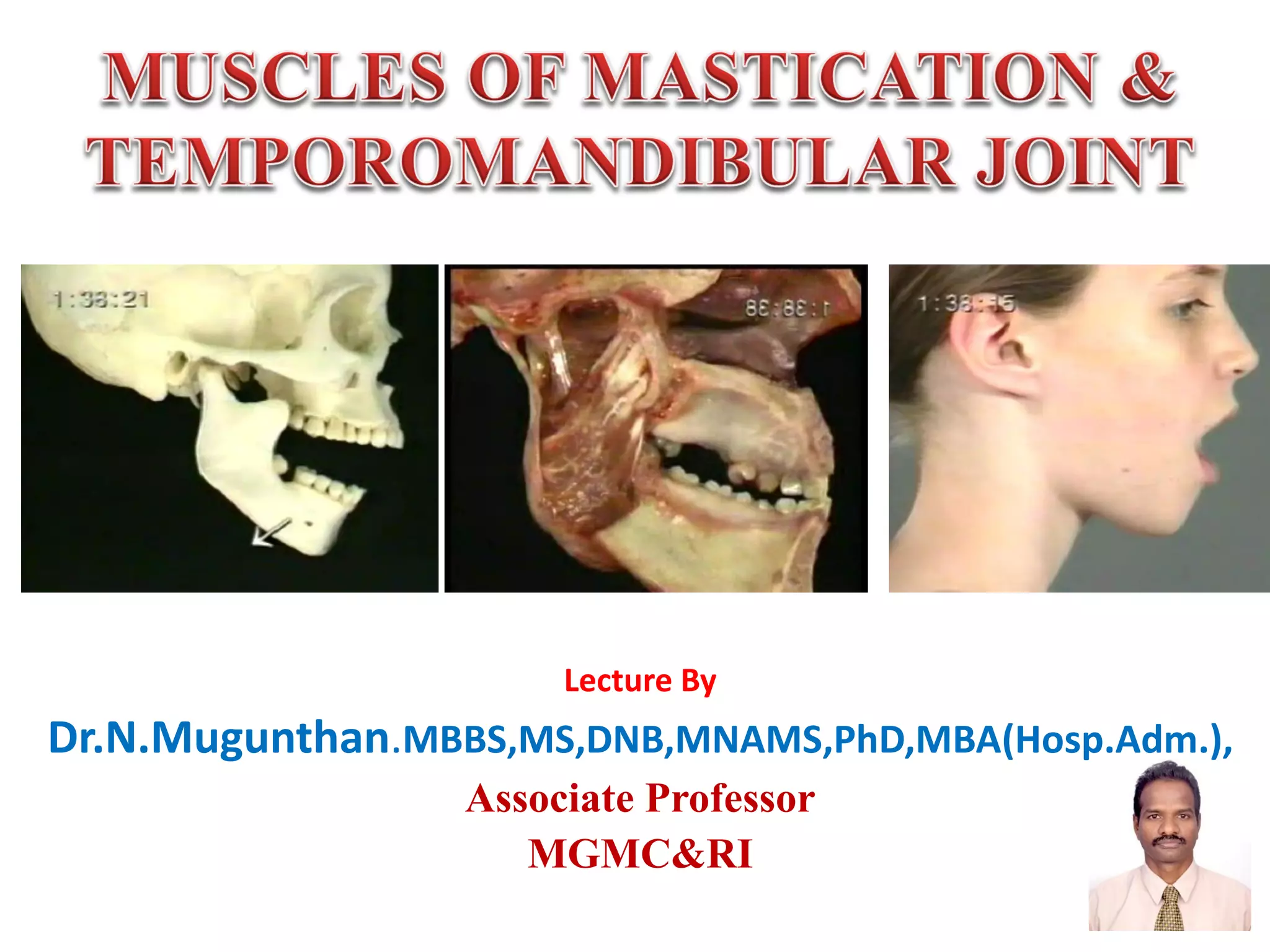 Muscles of mastication & TMJ Dr.N.Mugunthan | PDF