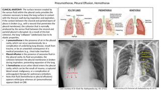 MUSCLES OF RESPIRATORY SYSTEM BY DR..pptx