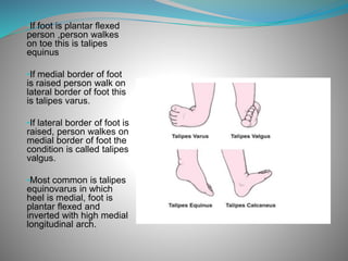 Muscles of sole | PPTX