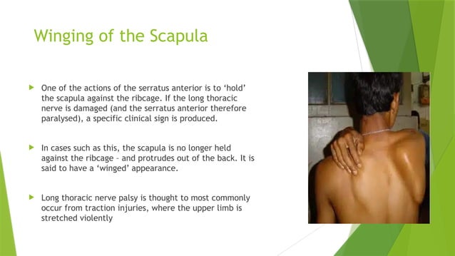 Muscles of the Upper Limb/pectoralis major | PPT