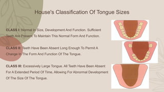 muscles of tongue and its prosthodontic implications | PPTX