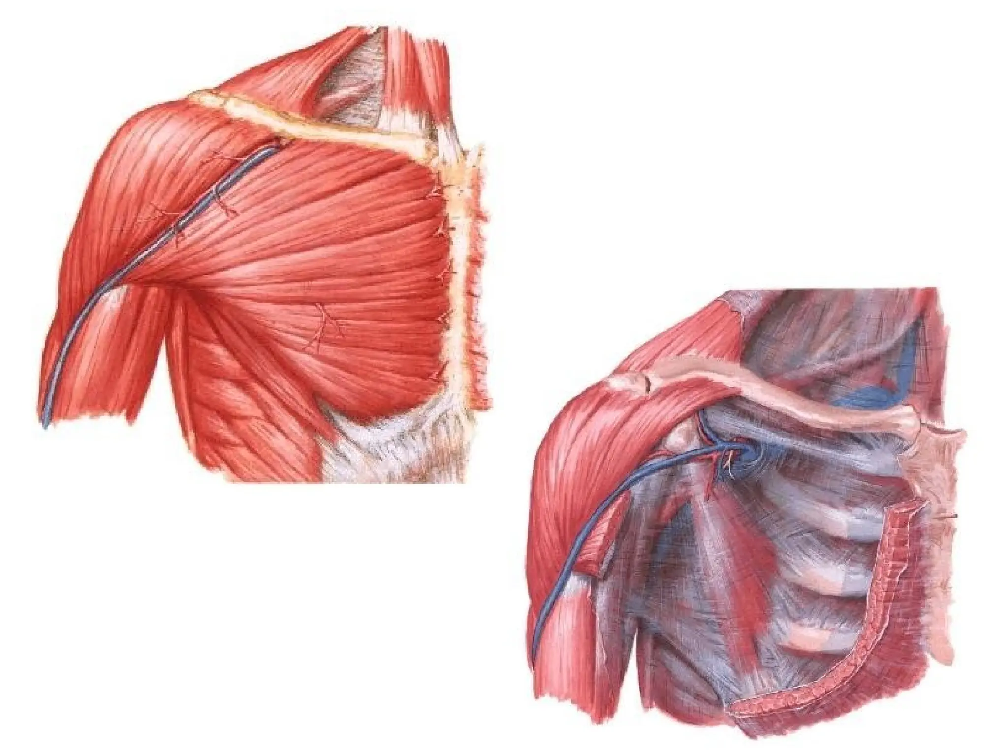 muscles_of_upper_limb showing all the muscles.pptx