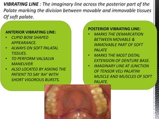 Muscles surrounding Complete Denture | PPTX