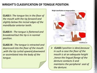 Muscles surrounding Complete Denture | PPTX