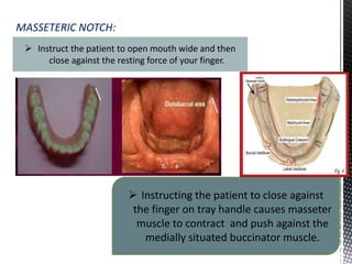 Muscles surrounding Complete Denture | PPT