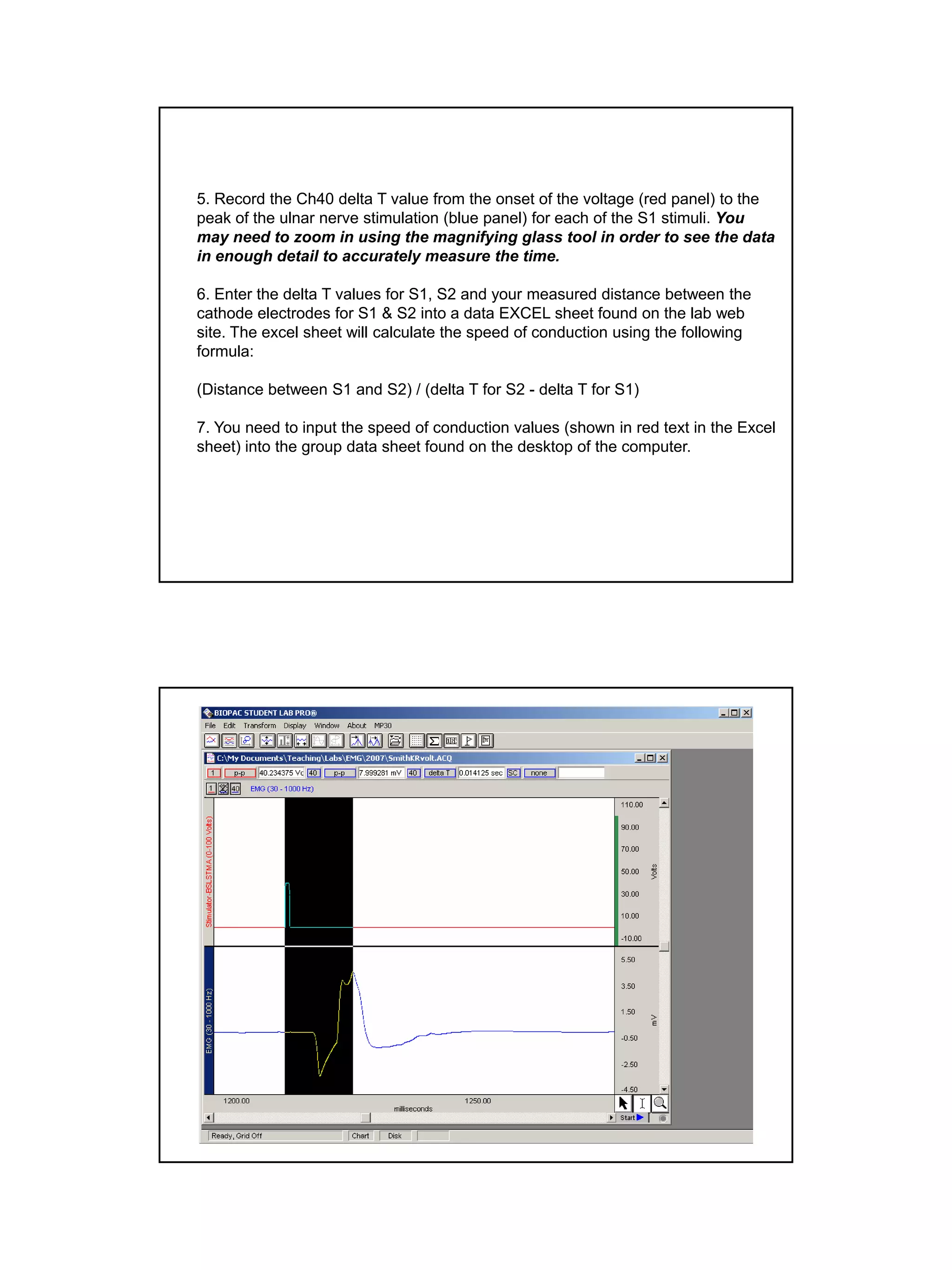 Muscle stretch reflex | PDF