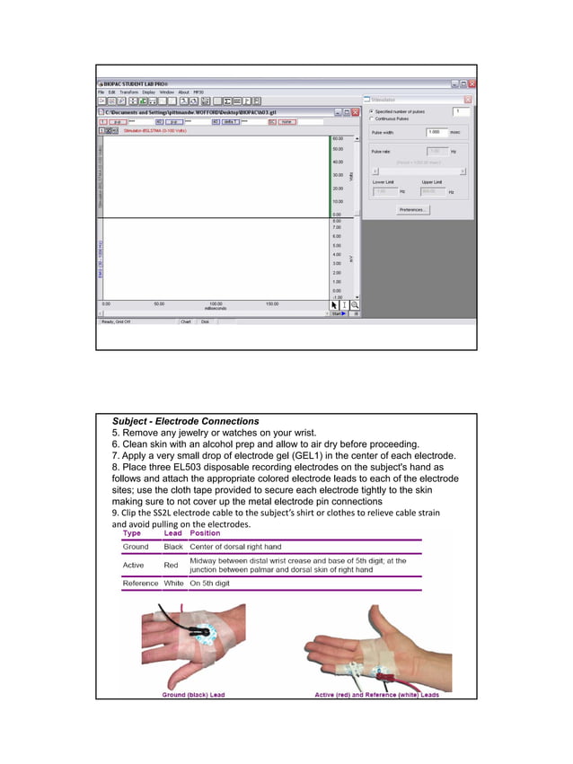 Muscle stretch reflex | PDF