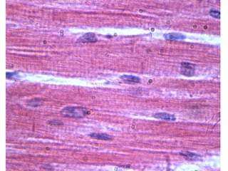 Cardiac Muscle Slide 400x