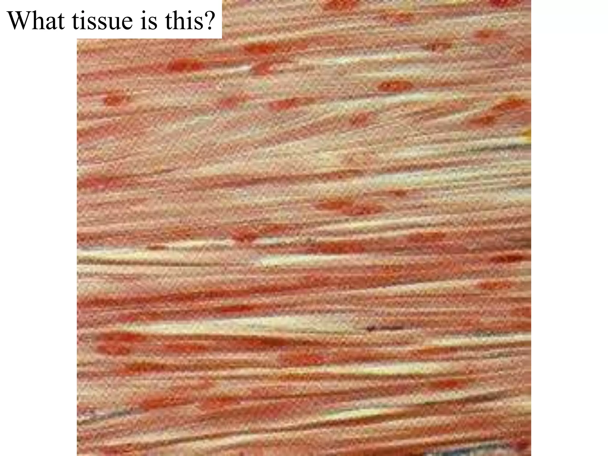 Muscle tissue practice questions | PPT