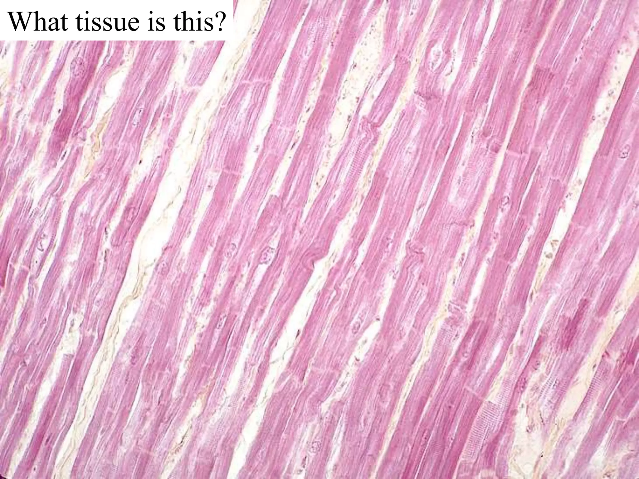 Muscle tissue practice questions | PPT