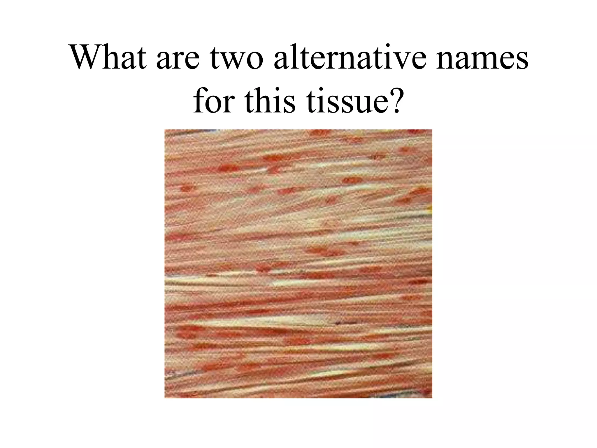 Muscle tissue practice questions | PPT
