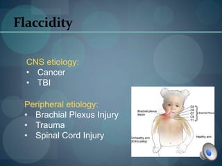 Muscle tone 11 | PPT