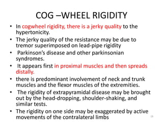 Cogwheel Rigidity