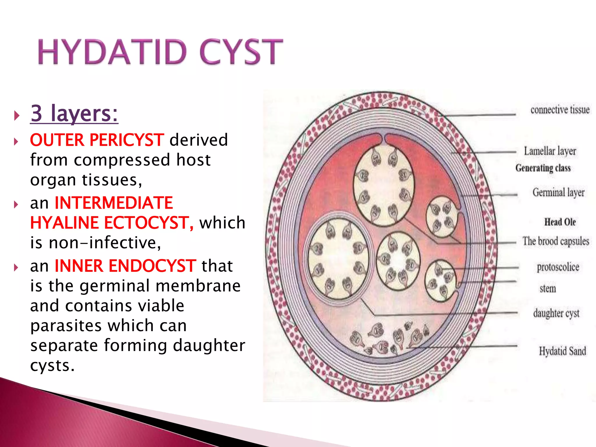 MUSCOLOSKELETAL HYDATID CYST.pptx
