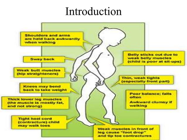 Muscular Dystrophies | PPTX | Physical Therapy | Wellness