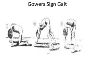 Muscular Dystrophies.pptx