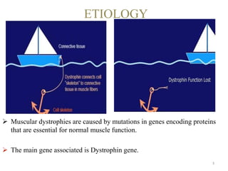 Muscular Dystrophies.pptx