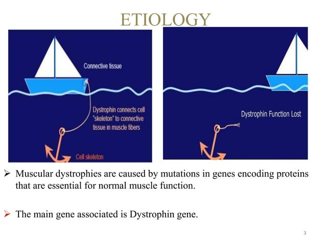 Muscular Dystrophies.pptx | Diseases and Conditions | Medical Health