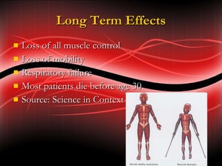 Muscular dystrophy | PPT