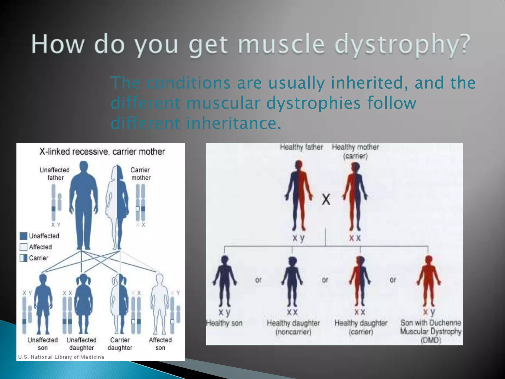 Muscular dystrophy | PPTX