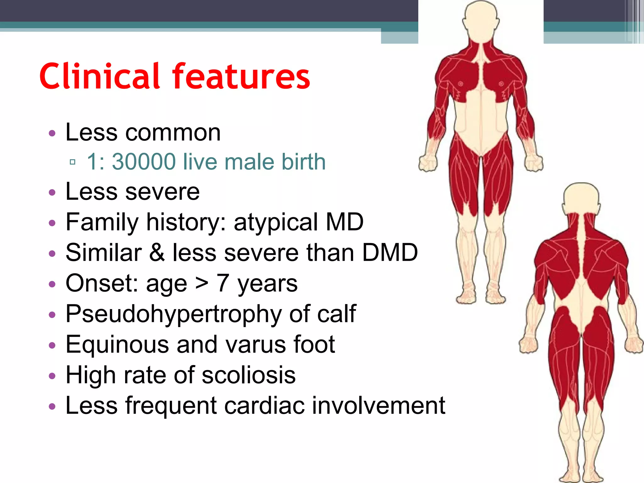 Muscular dystrophy | PPT