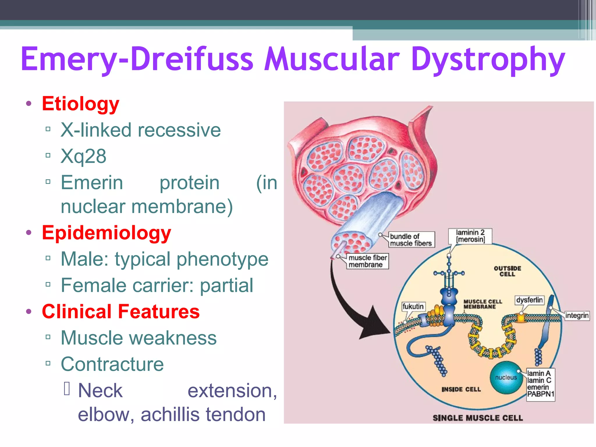 Muscular dystrophy | PPT