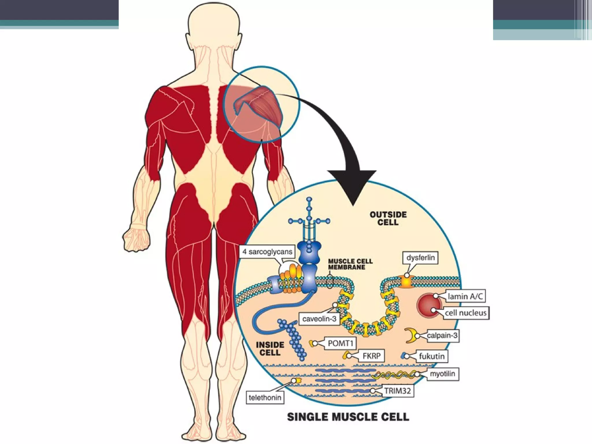 Muscular dystrophy | PPT