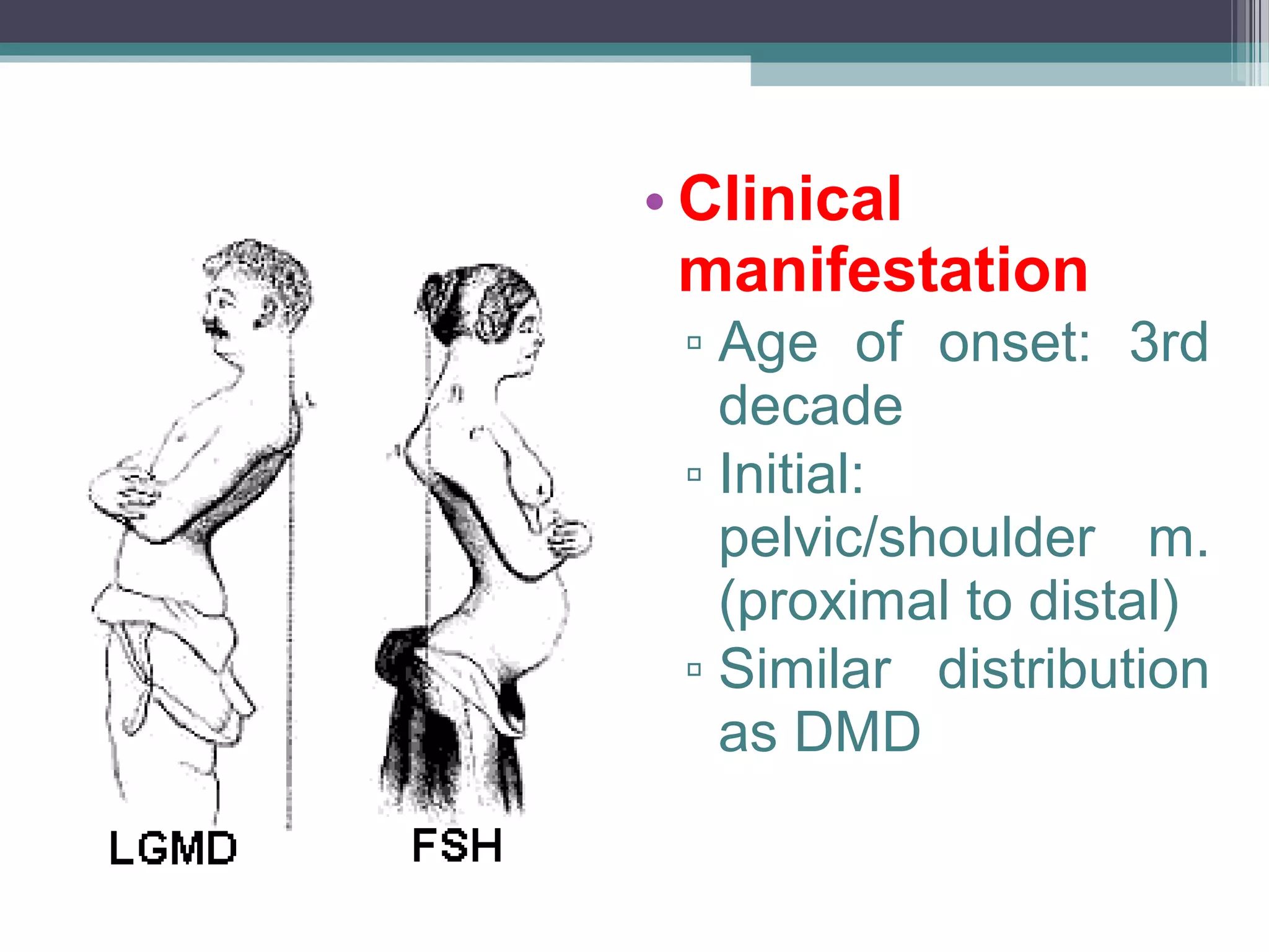 Muscular dystrophy | PPT