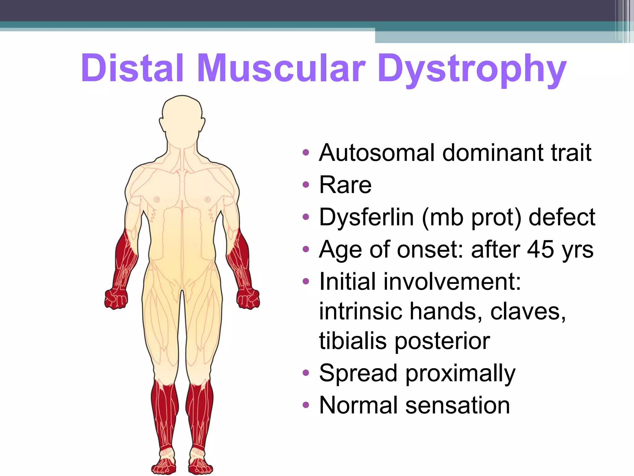 Muscular dystrophy | PPT