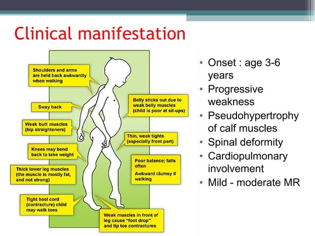 Muscular dystrophy | PPT | Bone and Joint Conditions | Diseases and ...