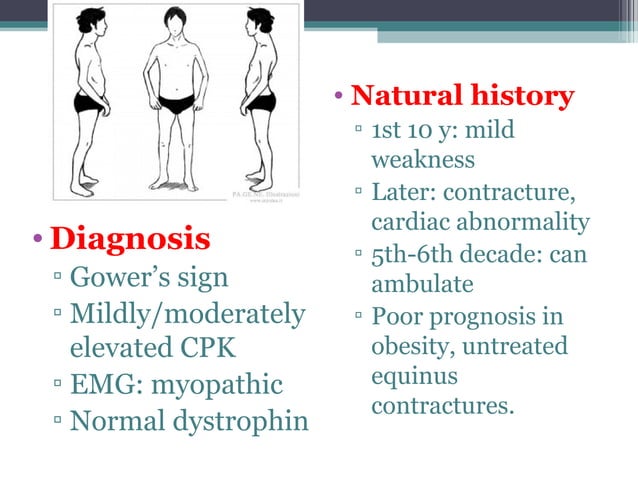Muscular dystrophy | PPT | Bone and Joint Conditions | Diseases and ...