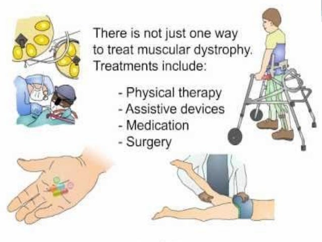 Muscular Dystrophy Treatment