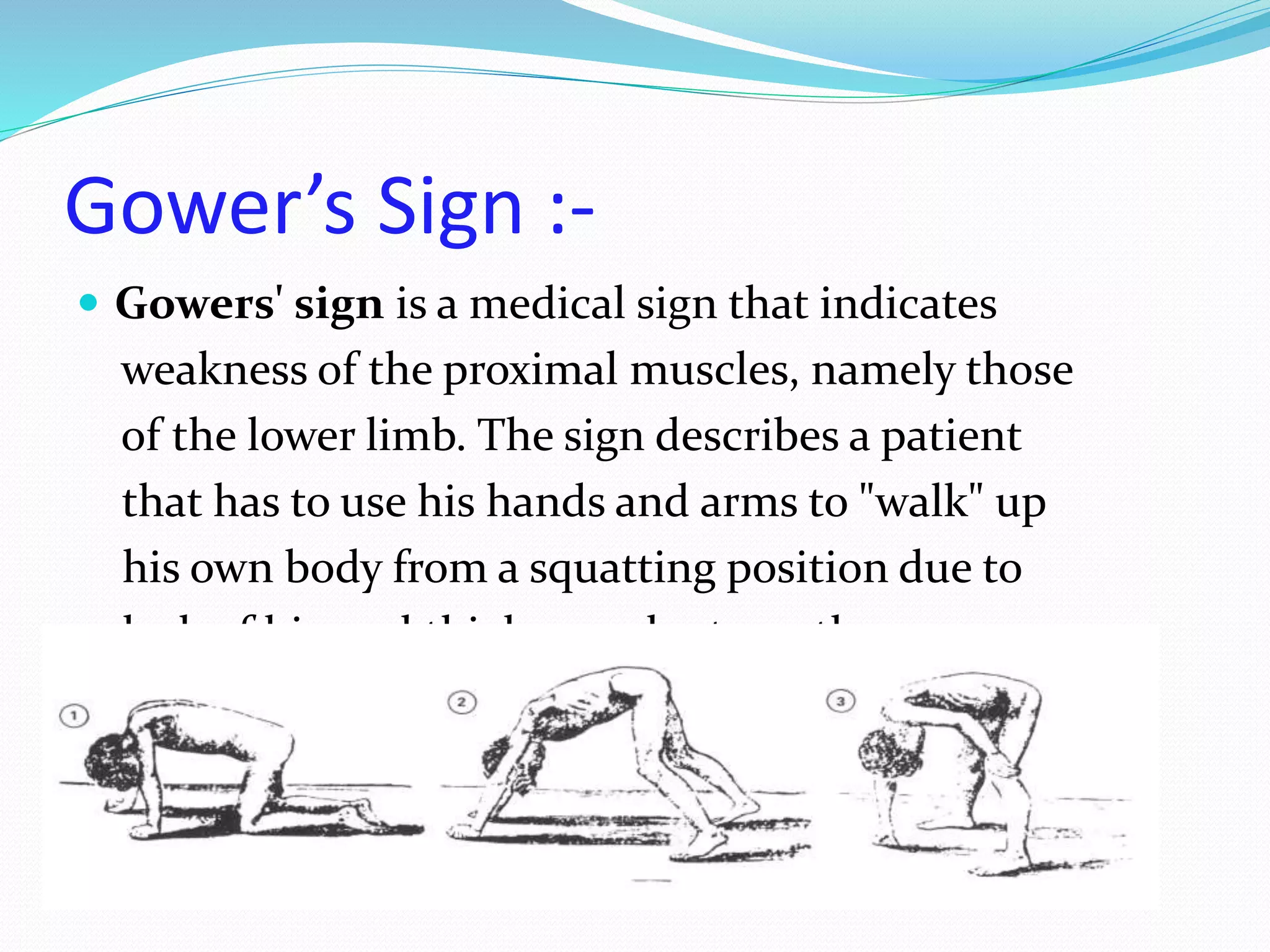 Muscular dystrophy | PPTX