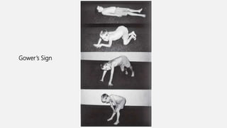 Muscular dystrophy | PPTX