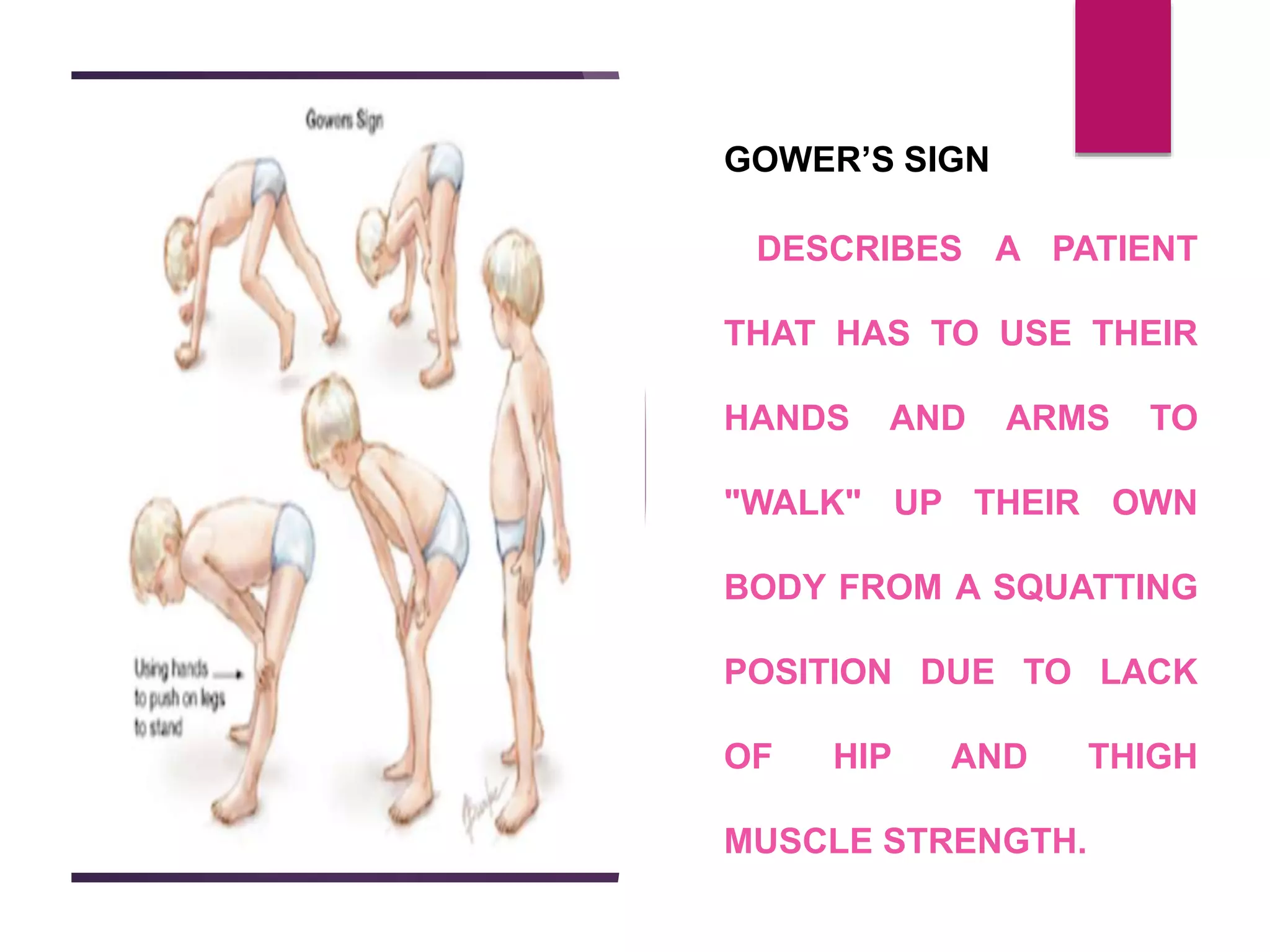 Muscular dystrophy | PPTX