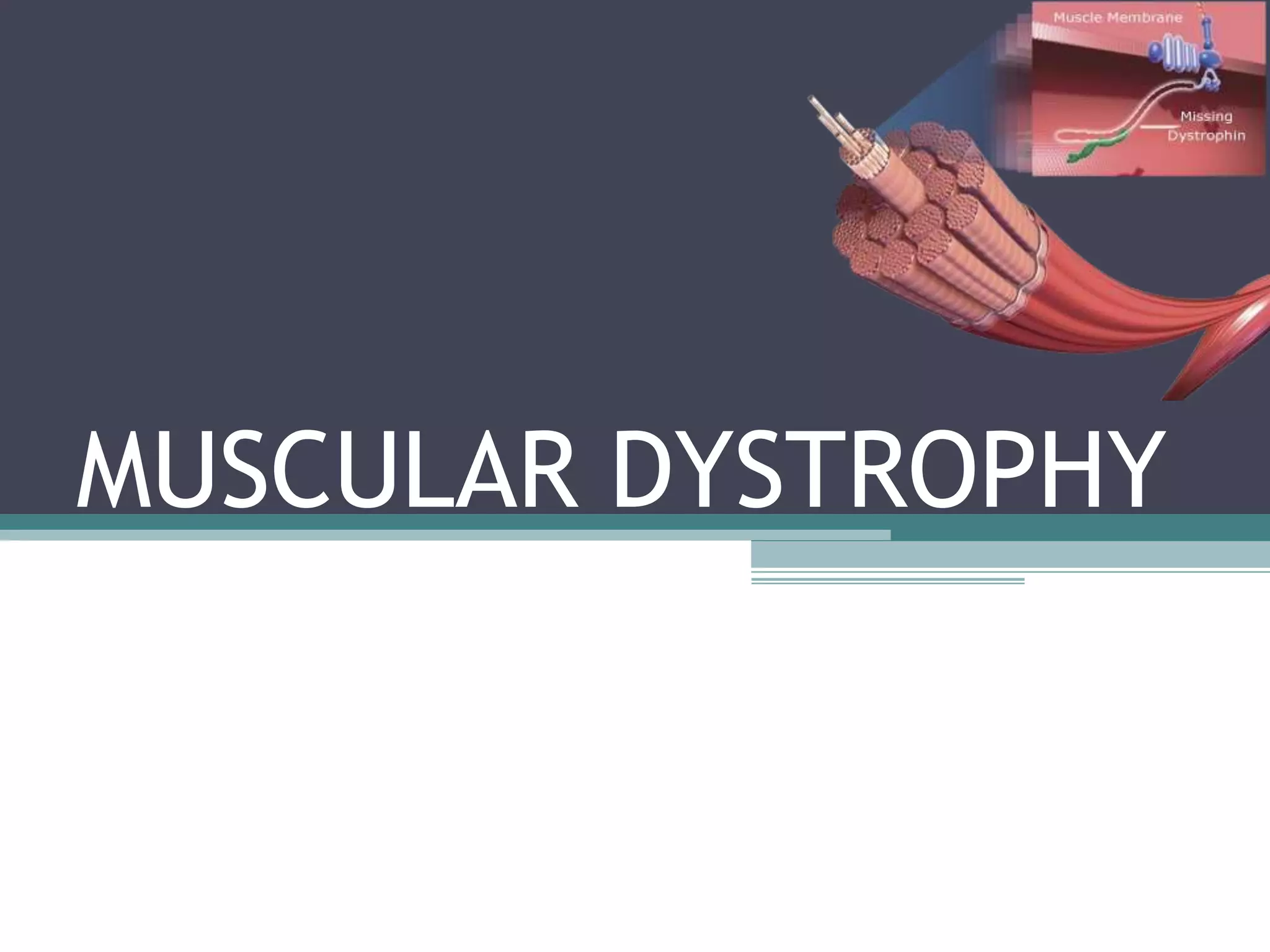 muscular dystrophy.pptx